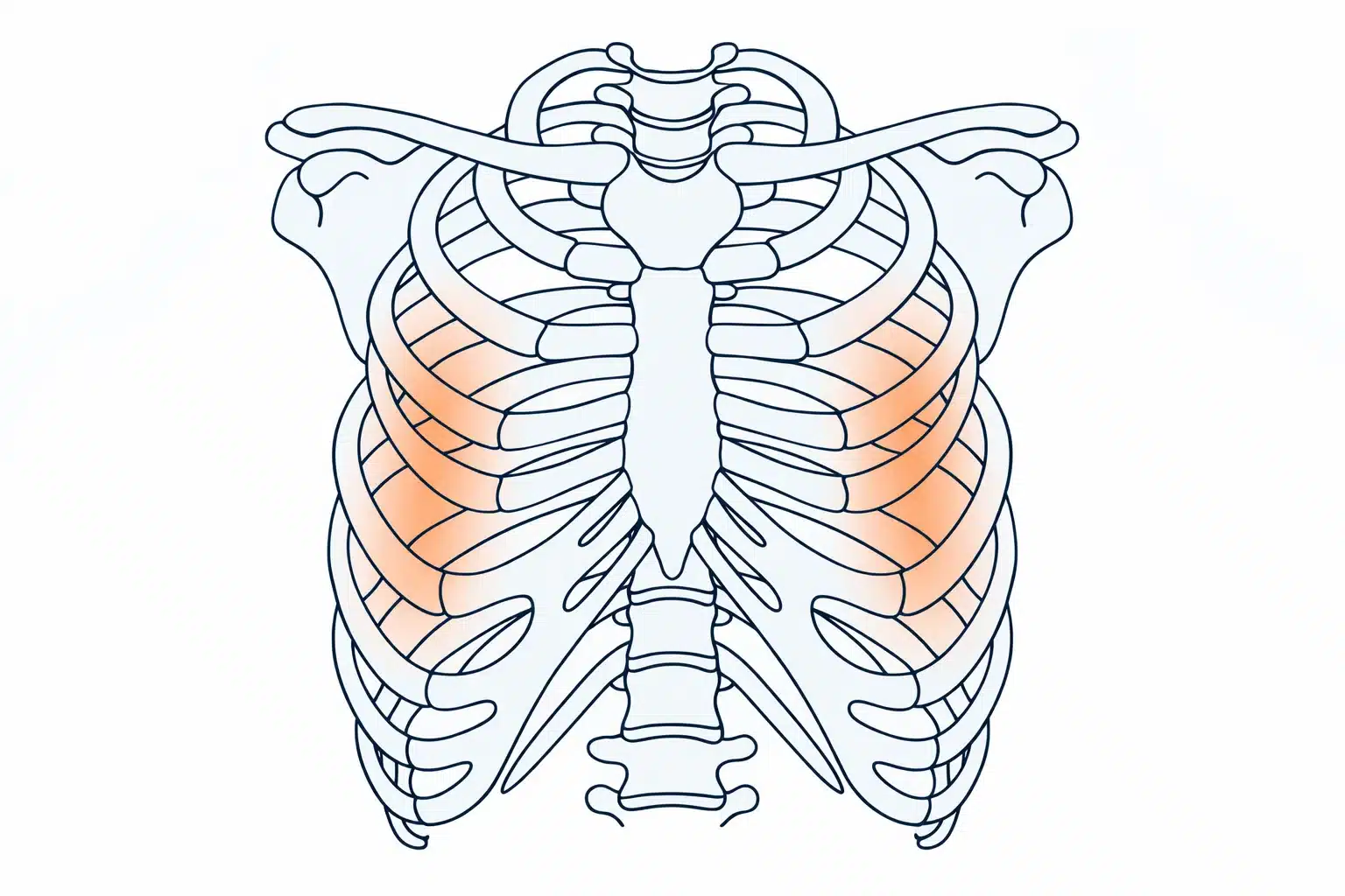 Slipping Rib Syndrome | Symptoms, Diagnosis & Treatment